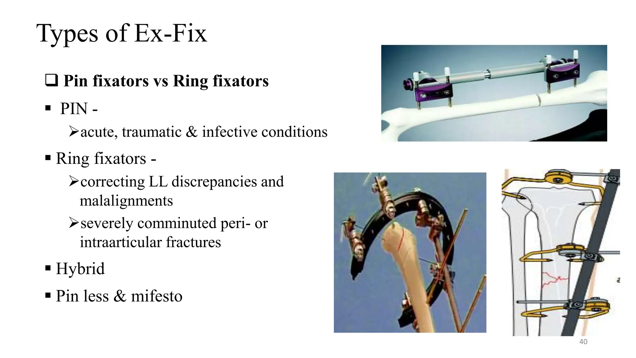 OPEN FRACTURE MANAGEMENT AND PRINCIPLE OF EXTERNAL FIXATION.pptx