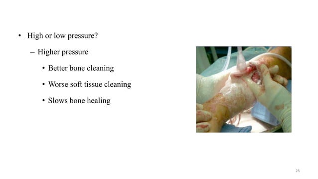 OPEN FRACTURE MANAGEMENT AND PRINCIPLE OF EXTERNAL FIXATION.pptx