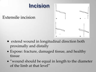Managment of Open fractures | PPTX