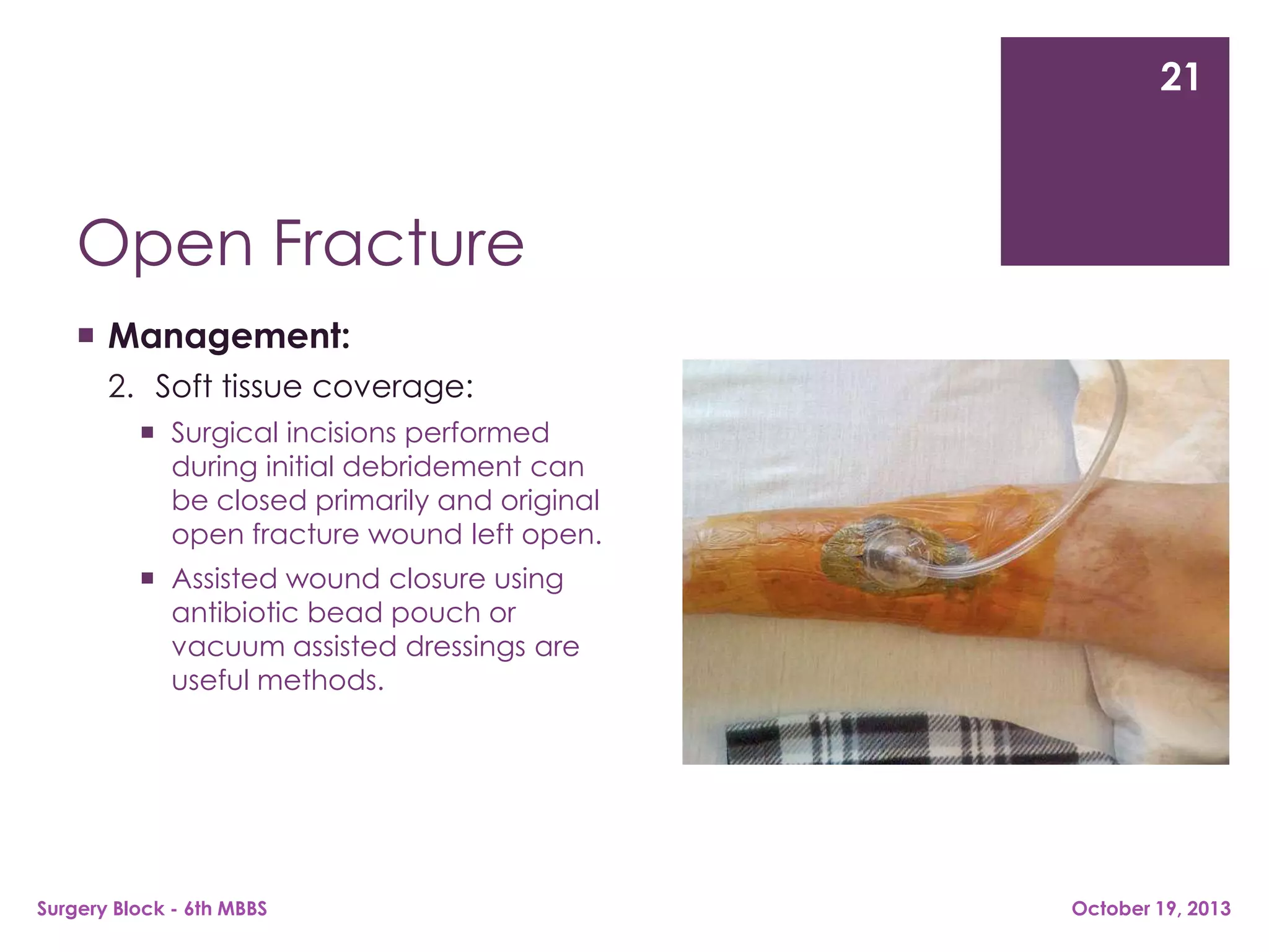Open Fractures | PPTX