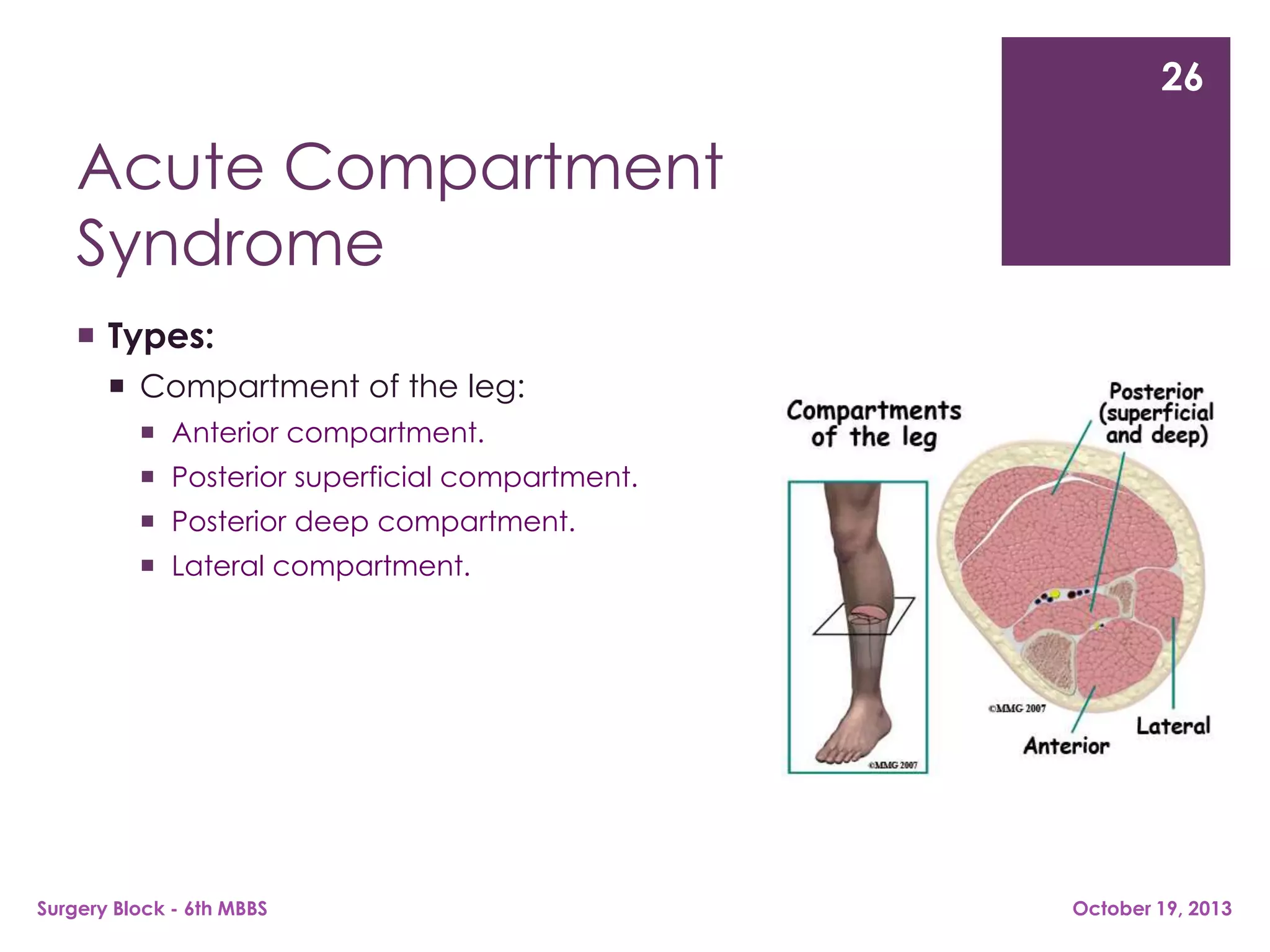 Open Fractures | PPTX