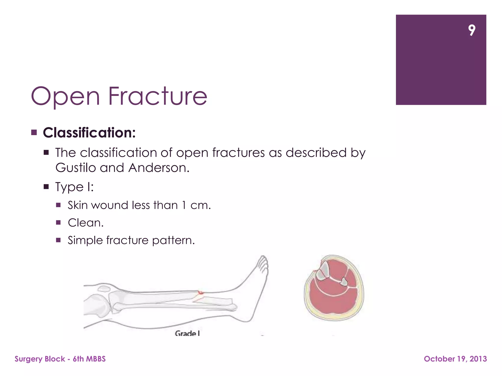 Open Fractures | PPTX