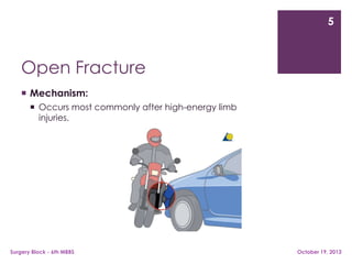 Open Fractures | PPTX