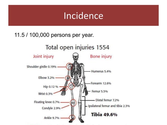 Open fractures | PPTX | First Aid | Injuries