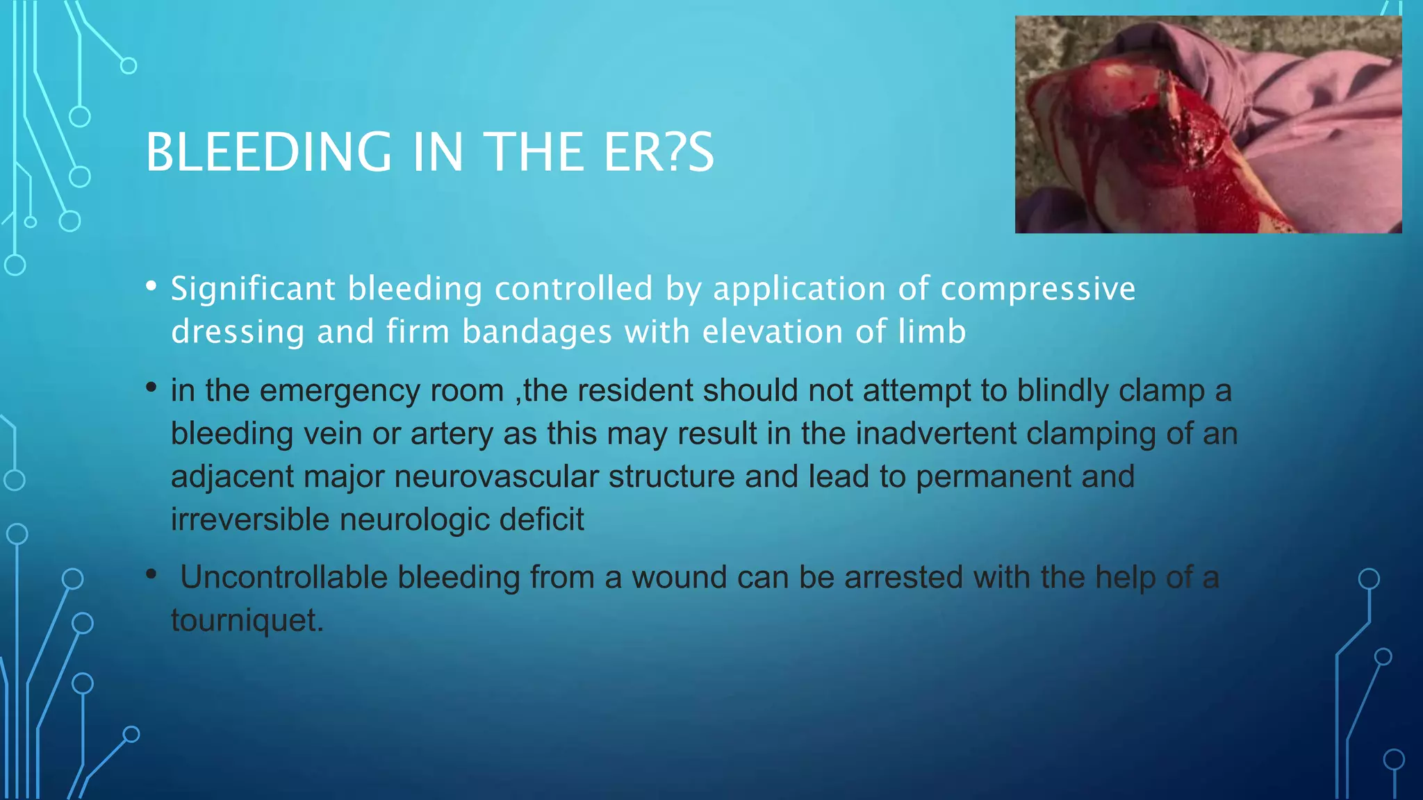 COMPOUND FRACTURES.pptx
