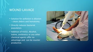 COMPOUND FRACTURES.pptx