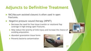 OPEN FRACTURES.pptx