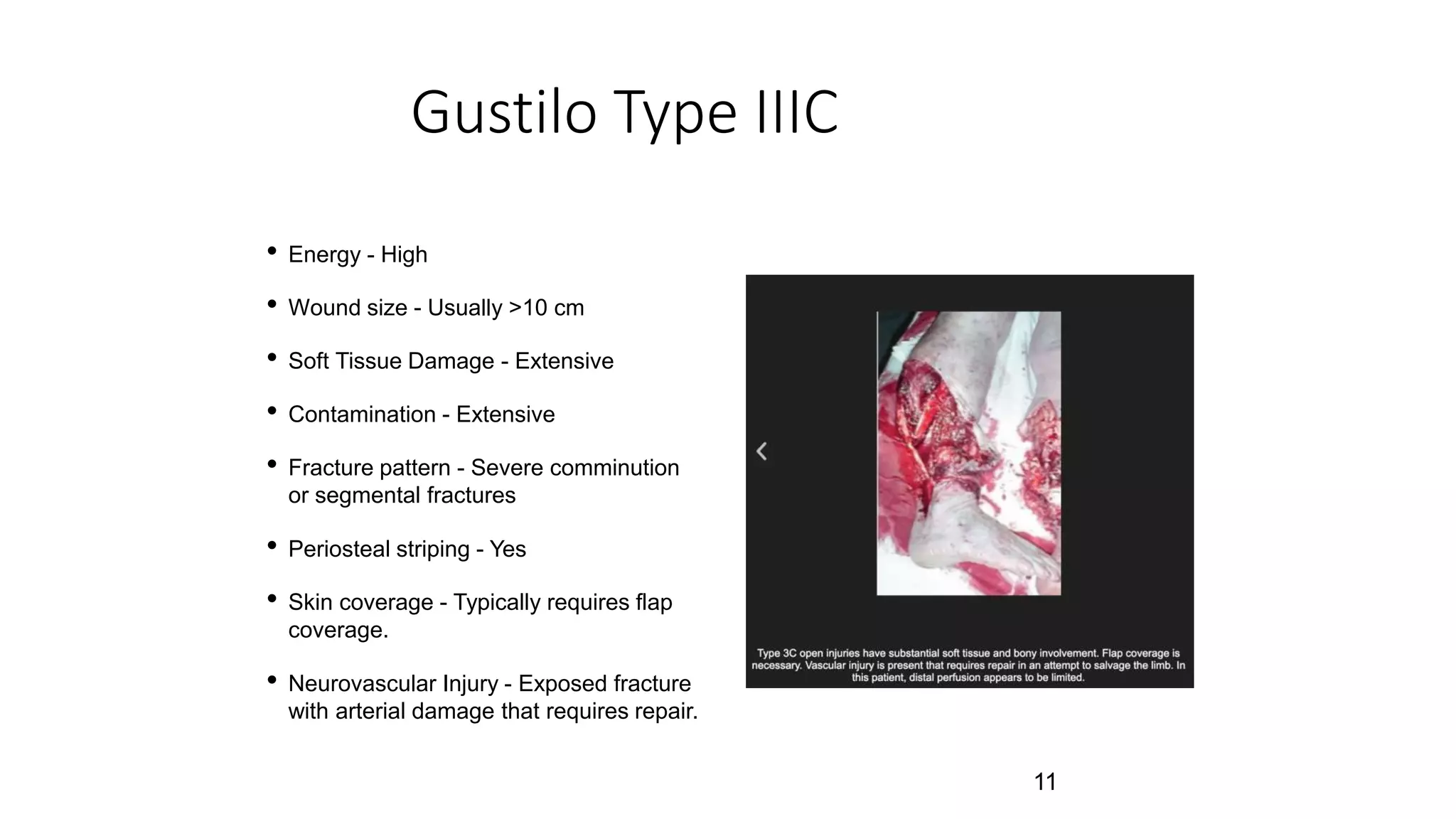 Management of Open Fractures and Pathological Fractures | PPTX