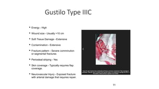 Management of Open Fractures and Pathological Fractures | PPTX