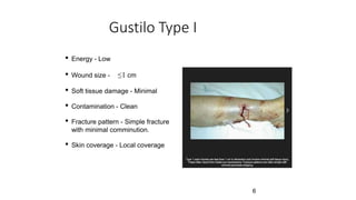 Management of Open Fractures and Pathological Fractures | PPTX