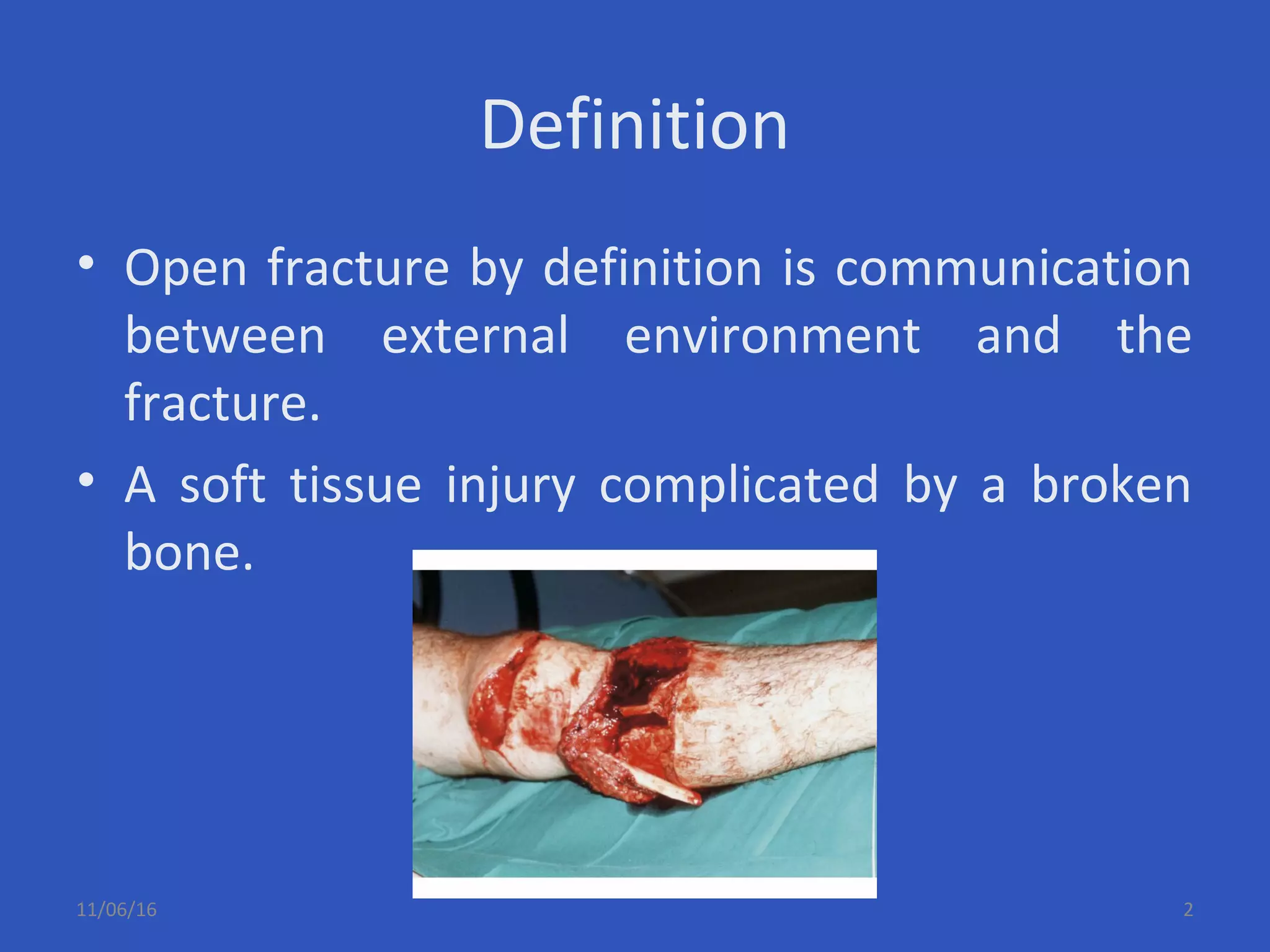 Open Fractures Classification and Management. | PPT