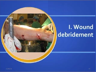 Open Fractures Classification and Management. | PPT