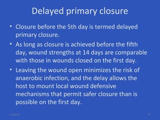 Open Fractures Classification and Management. | PPT