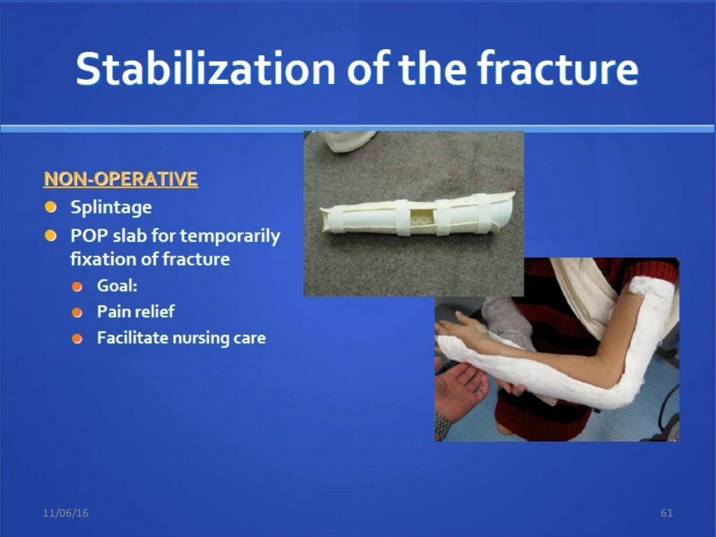 Open Fractures Classification and Management.