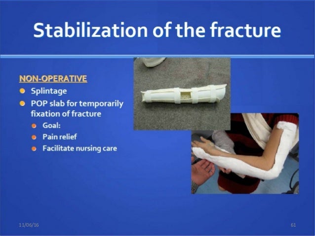 Open Fractures Classification and Management.