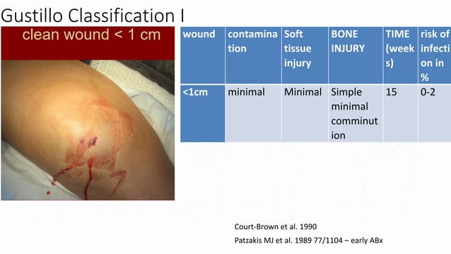 Open fractures ppt | PPTX | First Aid | Injuries