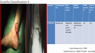 Open fractures ppt | PPTX