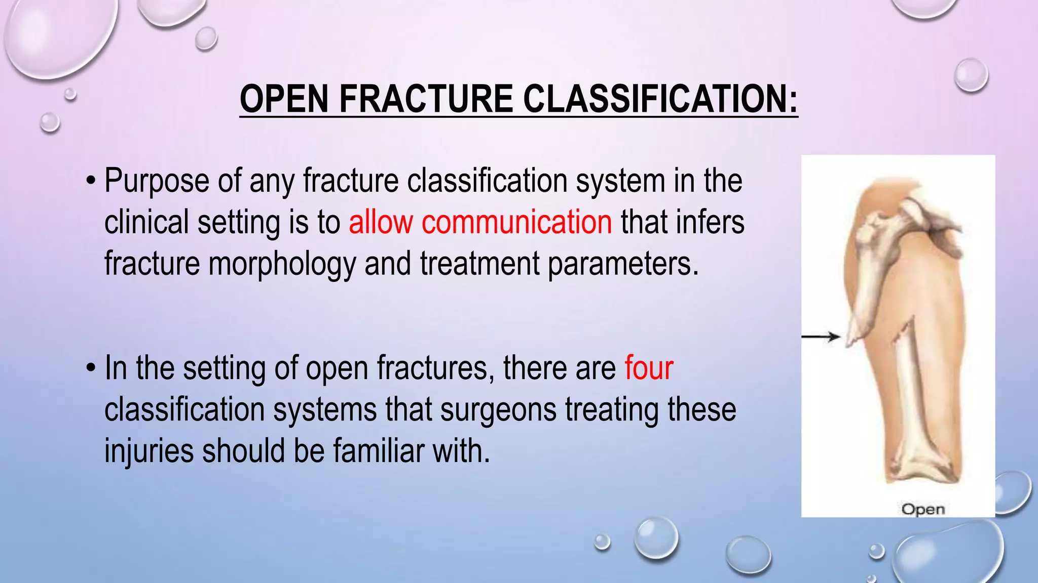 Open fractures Punit | PPT