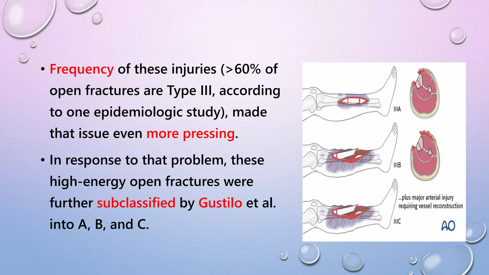 Open fractures Punit | PPTX