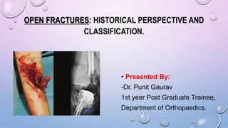 Open fractures Punit | PPTX
