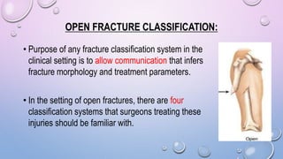 Open fractures Punit | PPTX