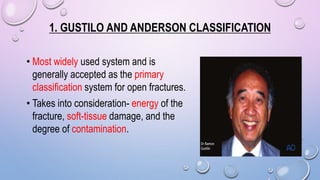 Open fractures Punit | PPTX