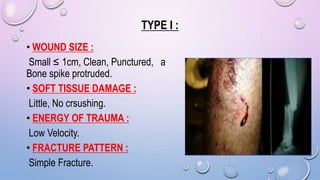 Open fractures Punit | PPTX