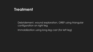 Open Fraktur Tibia Fibulae - Julang ENGLISH.pptx