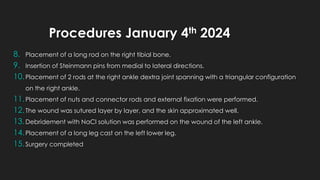 Open Fraktur Tibia Fibulae - Julang ENGLISH.pptx