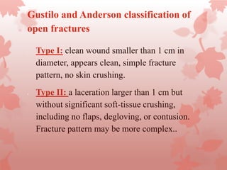 Open fructures | PPTX