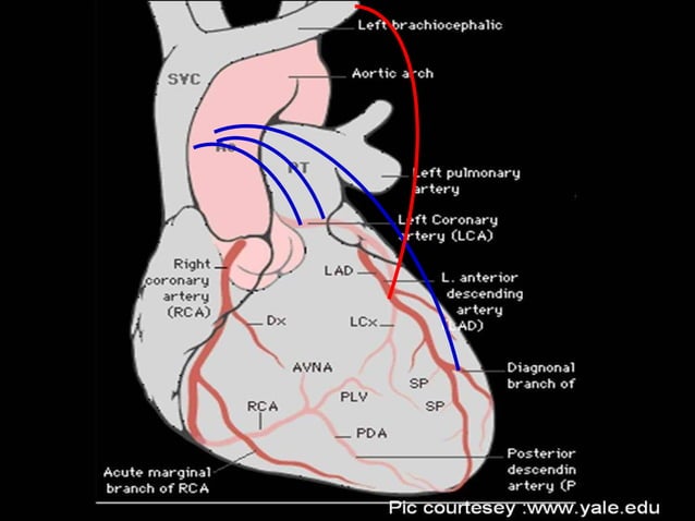 Open Heart Surgery/ Coronary Artery Bypass Graft