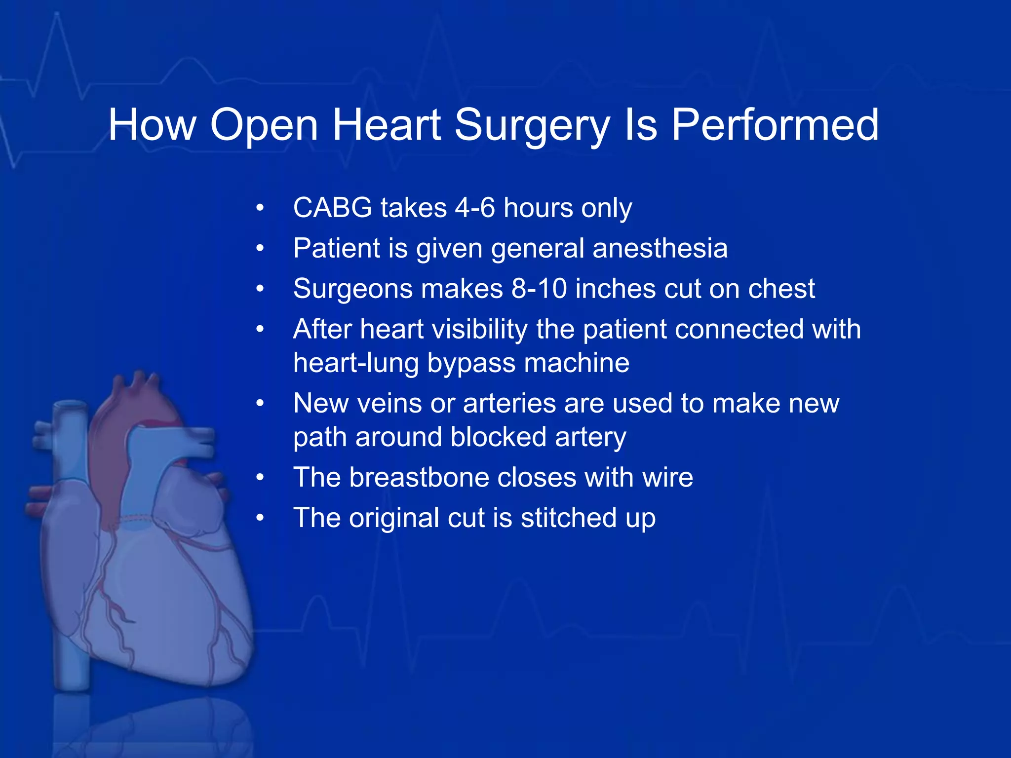 Open Heart Surgery | PPTX