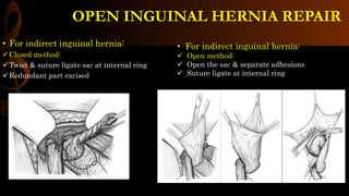 Open inguinal hernia repair / operative surgery | PPTX