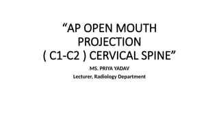 Open Mouth view spine cervical system .pptx