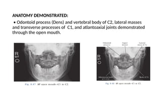 Open Mouth view spine cervical system .pptx