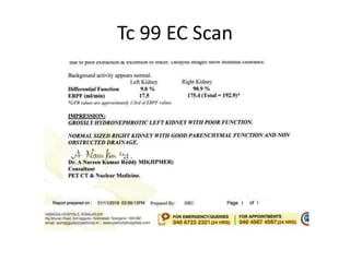 Renal hydatid disease | PPT