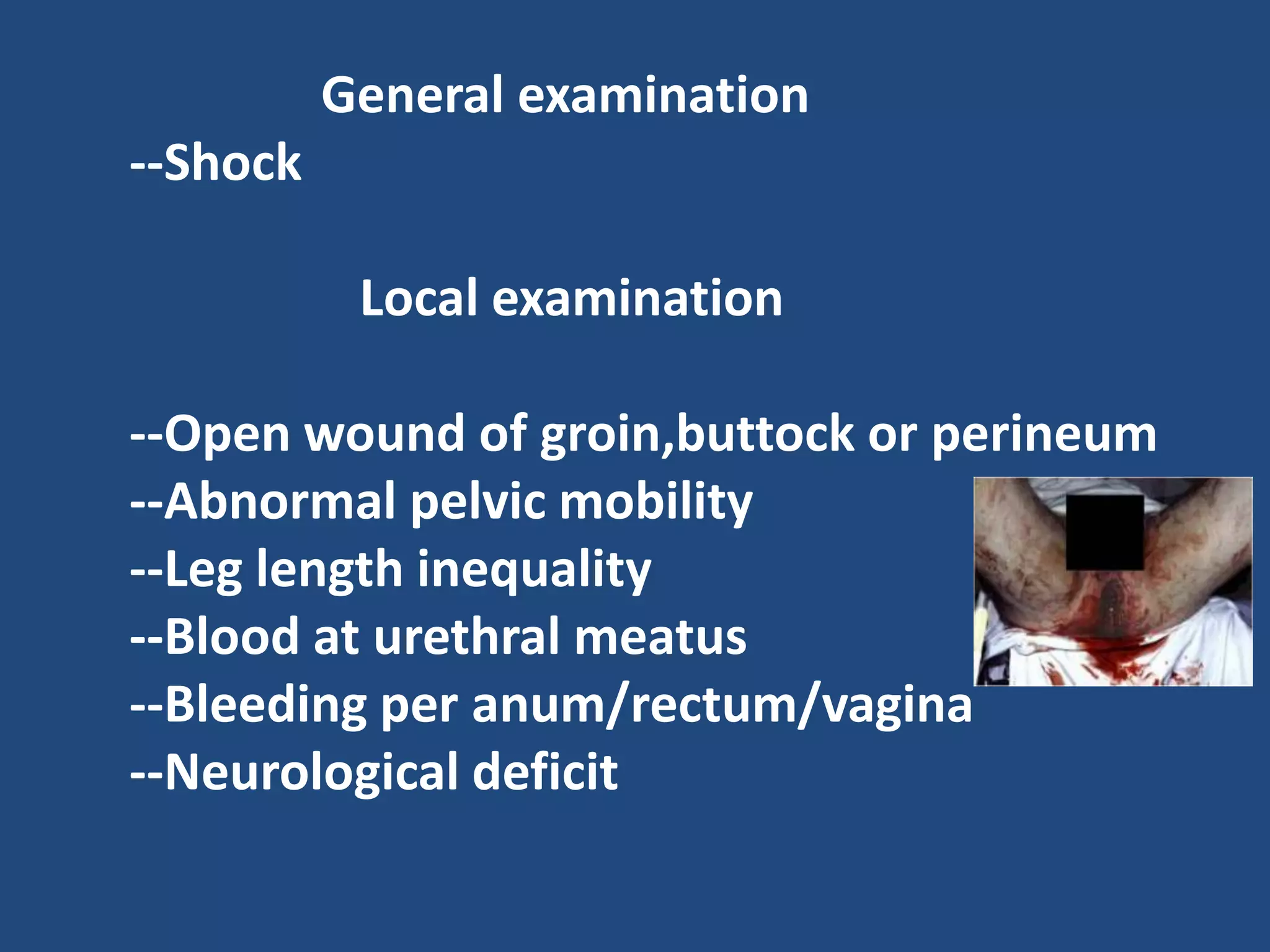 Open pelvic trauma and associated injury management | PPTX