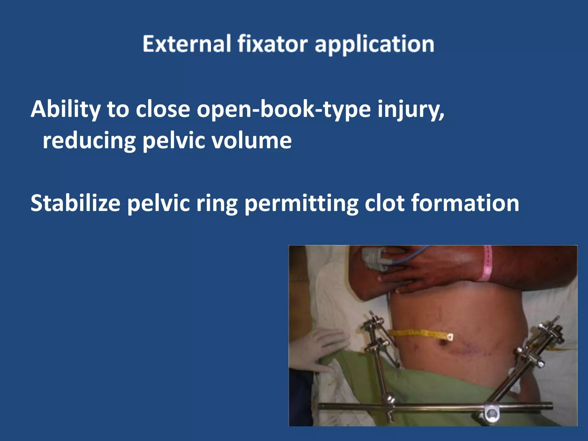 Open pelvic trauma and associated injury management | PPTX