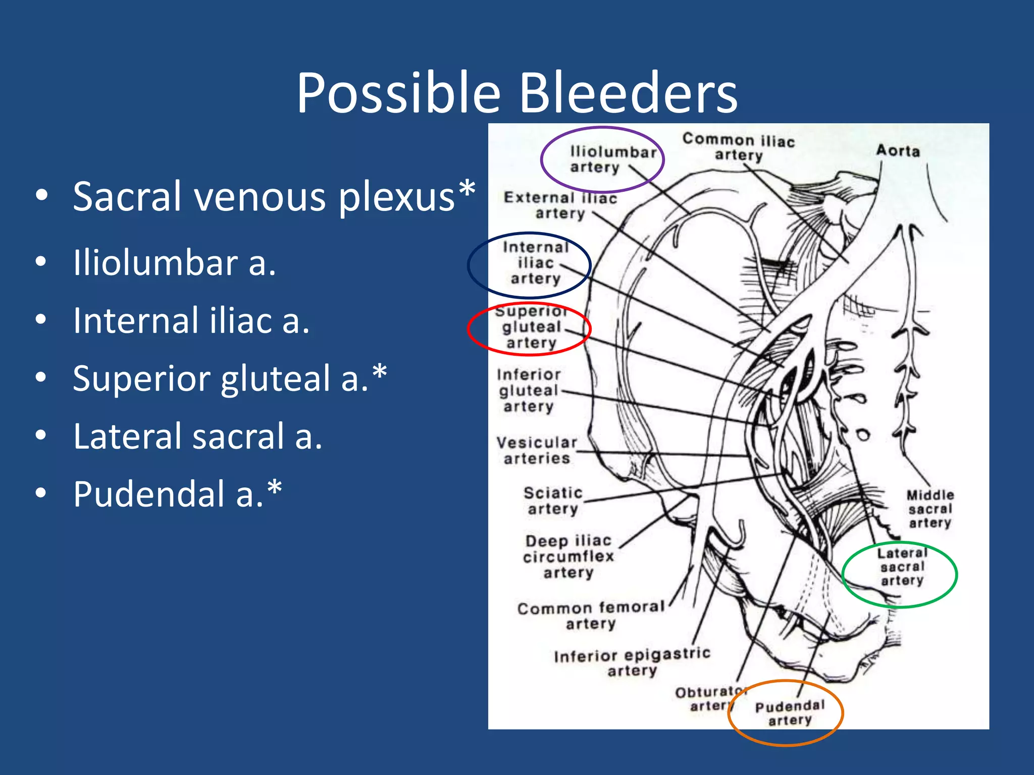 Open pelvic trauma and associated injury management | PPTX