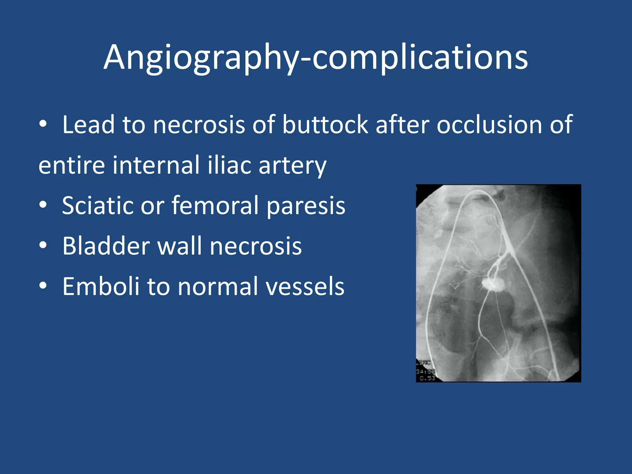 Open pelvic trauma and associated injury management | PPTX