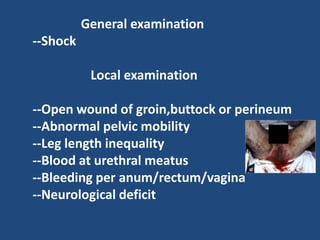 Open pelvic trauma and associated injury management | PPTX