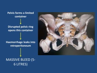 Open pelvic trauma and associated injury management | PPTX