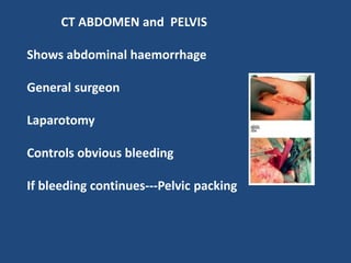 Open pelvic trauma and associated injury management | PPTX