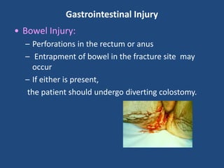 Open pelvic trauma and associated injury management | PPTX