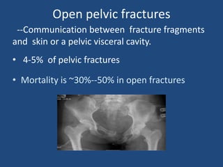 Open pelvic trauma and associated injury management | PPTX