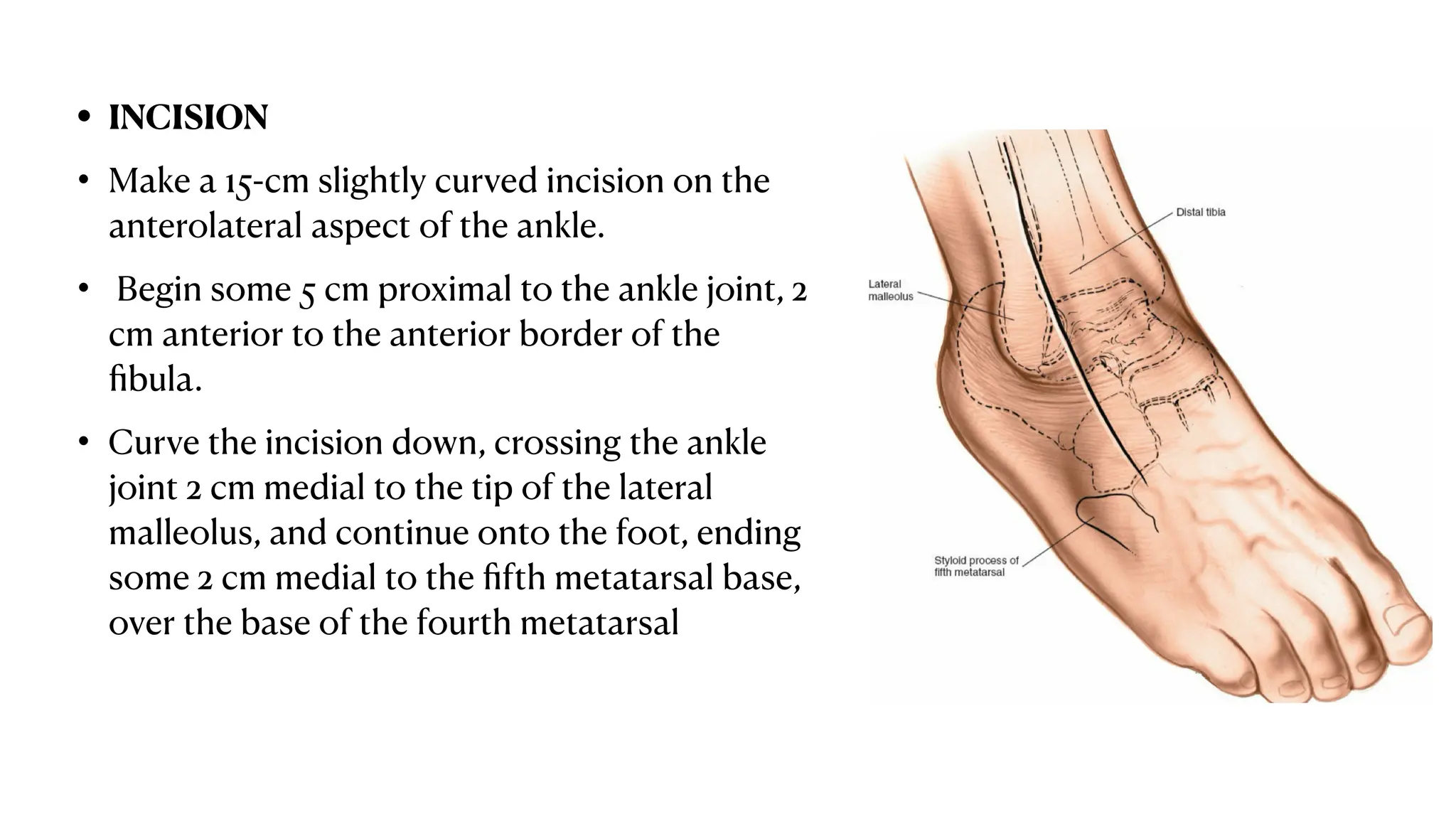 Approaches to foot and ankle Presentation.pdf
