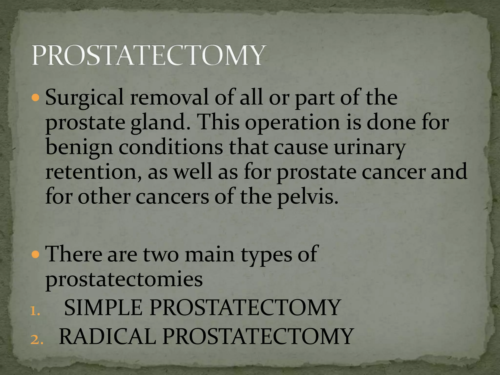 Open prostatectomy tray | PPTX