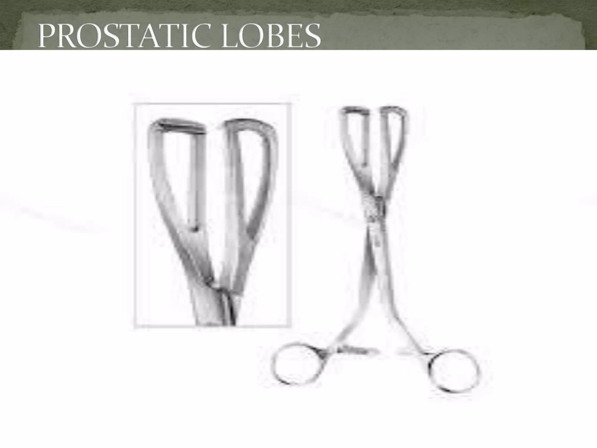 Open prostatectomy tray | PPTX