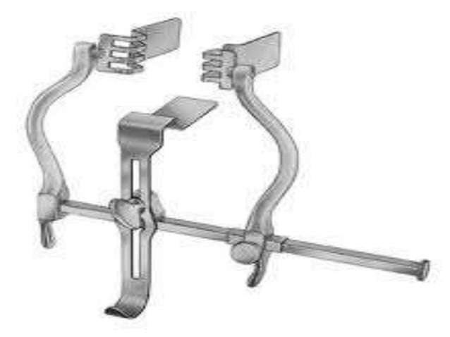 Open prostatectomy tray | PPTX