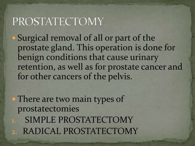 Open prostatectomy tray | PPTX